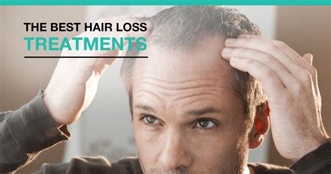Best Hair Loss Medicine Uk At Mark Ezzell Blog
