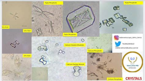 Grepmed Urine Microscopy Crystalluria Visual Guide Triple Phosphate