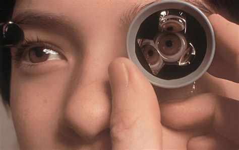 Гониоскопия в сети клиник Семейный доктор Москва Стоимость исследования