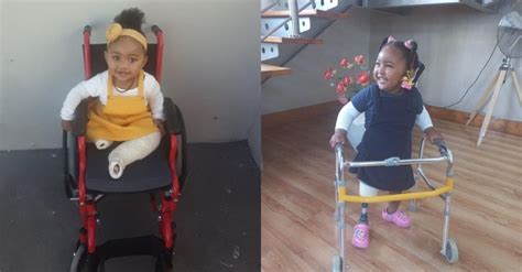 Klein Leah Rose 2 Stap Eindelik Ná Sy Prostetiese Voet Kry Huisgenoot