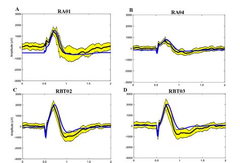 Representative Patient Dataset Showing Multivariate Transfer Function Download Scientific