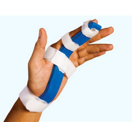 Exquisite Comfort With The Strip Finger Splint G Aapson Orthotics