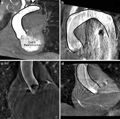 part based object detection and segmentation radiology key