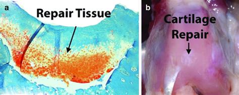 3 Osteochondral Defect Performed In A Left Knee Of A Rabbit Model A Download Scientific