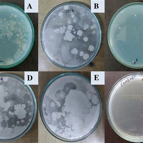 Phylogenetic Tree Of Comamonas Testosterone Sequence Download
