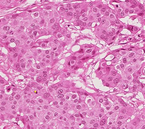 Mitosis Datasetnew Object Detection Dataset By Scale Sphere Solutions
