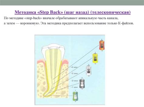 Эндодонтическое лечение презентация онлайн