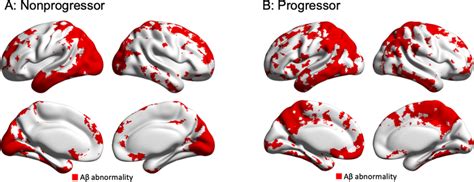 Regional Patterns Of Amyloid Beta Aβ Abnormality Differentiate Aβ Download Scientific Diagram