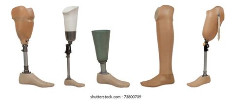 Leg Prosthesis Types