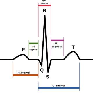 PDF Fractional Fourier Transform Based QRS Complex Detection In ECG Signal