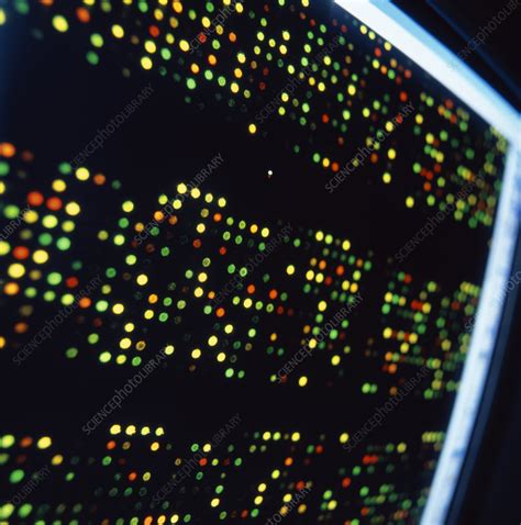 Dna Microarray Stock Image G210 0932 Science Photo Library