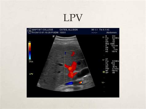Ppt Mesenteric Doppler Powerpoint Presentation Free Download Id