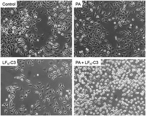 Cell Rounding Induced By Lfn C3 Hela Cells Were Treated With Pa 10