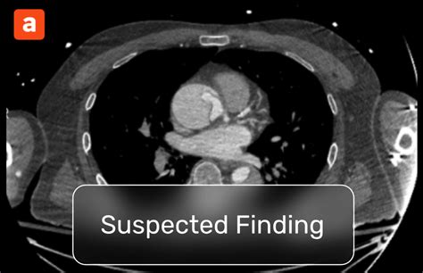 Aidoc Expands Aios Platform With Seven New Algorithms Applied Radiology Aidoc Expands Aios Platform With Seven New Algorithms Applied Radiology