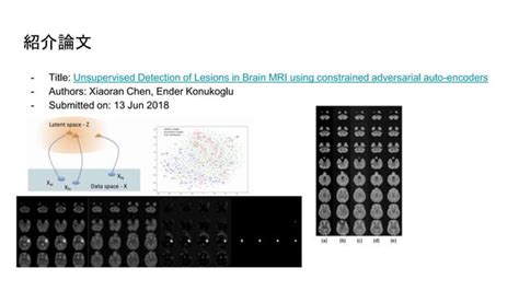 Unsupervised Detection Of Lesions In Brain Mri Using Constrained Adversarial Auto Encoders Ppt