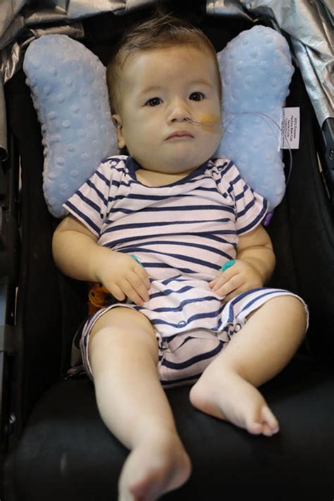 Living With Prader Willi Syndrome Positive Exposure