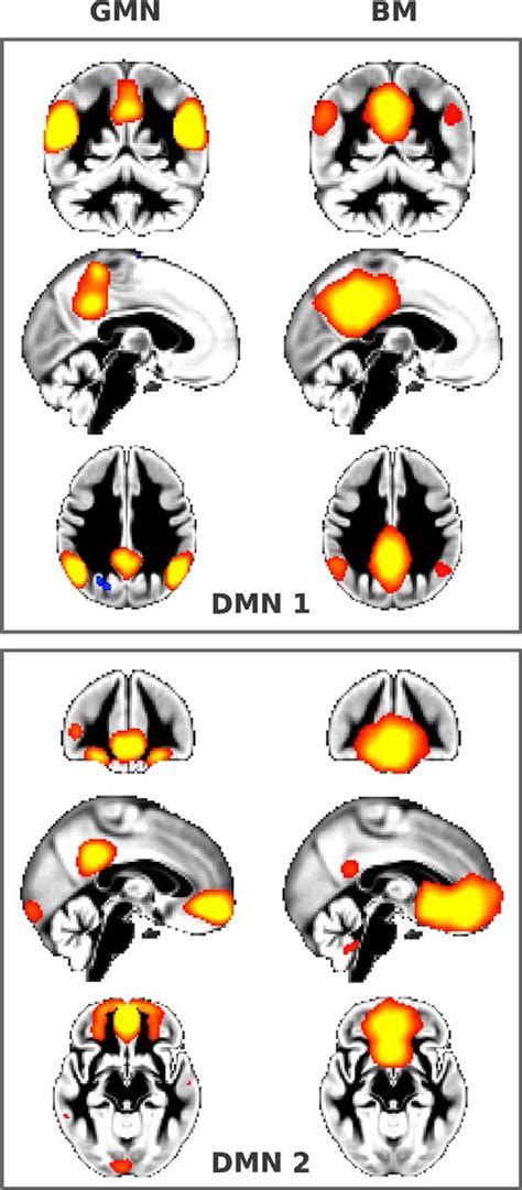 Structural Variability In The Human Brain Reflects Fine Grained Functional Architecture At The