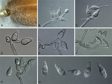 Il Brusone La Principale Minaccia Del Riso Microbiologia Italia
