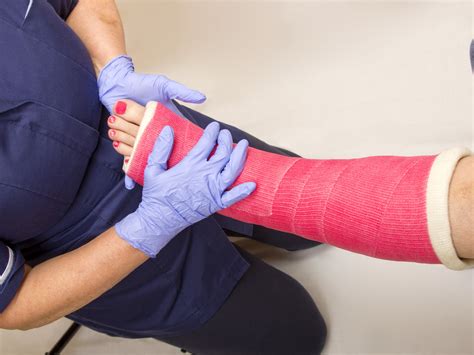 Other Injuries Tocci Law Long Island New York