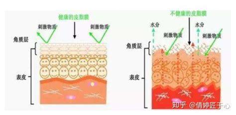 皮肤吸收能力的强弱和角质层的薄厚有很大的关系 知乎
