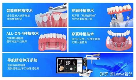 种植牙能用多长时间种牙5年后的真实感受 知乎