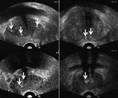 Sample Fiducials Identified Download Scientific Diagram