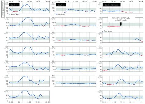 The Freestyle Libre Data 6 Days Prior To The Visit To The Hospital