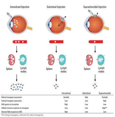 Gene Therapy For Inherited Retinal Disease