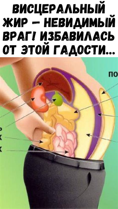 Висцеральный жир — невидимый враг Избавилась от этой гадости… Artofit