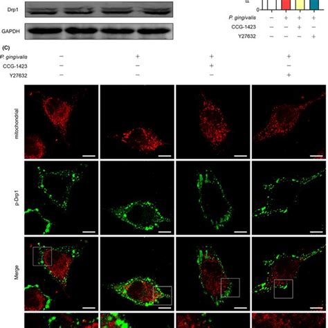 Inhibition Of Rhoarock Pathway Attenuated The Expression And