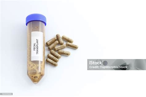 대변 이식 또는 대변 이식 클로스트리디움 박테리아 감염과 같은 지속적인 소화기 질환을 치료하기 위한 분변 미생물군이 포함된 알약 또는 의약품 배설물에 대한 스톡 사진 및