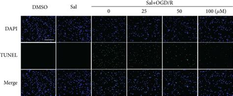 Sal Reduced The Apoptosis Of Primary Neurons And Promoted Neuronal