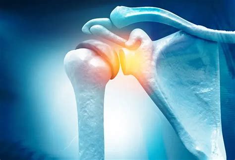 Can A Torn Rotator Cuff Heal On Its Own Treatment