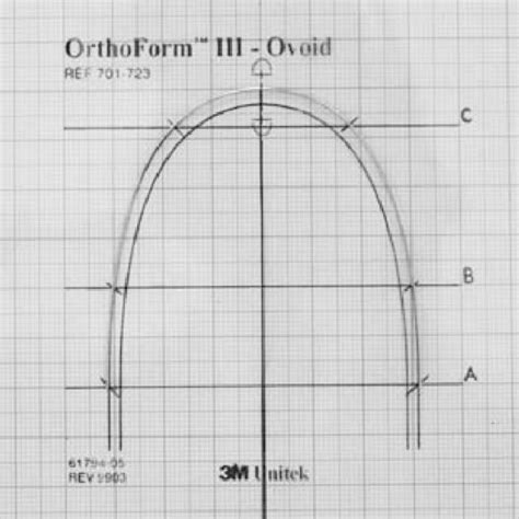 Archwire Superposed On The Diagram With Demarcation Of The Points In Download Scientific