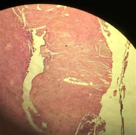 Specimen After Removal Download Scientific Diagram