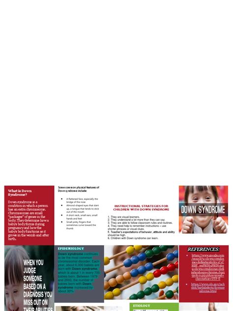 Brochure Down Syndrome Pdf Down Syndrome Syndrome