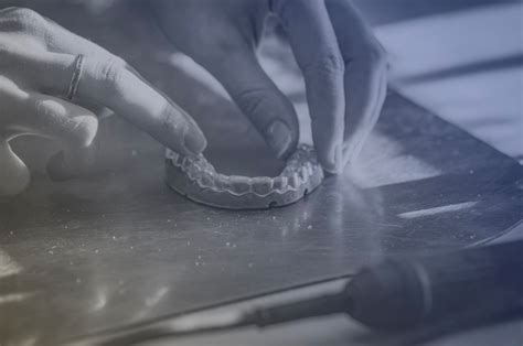 Essix Retainers — Pinnacle Prosthetics