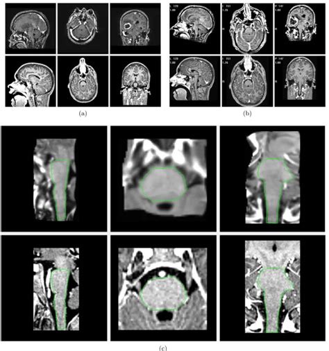 The Benefit Of Automatic Segmentation Of