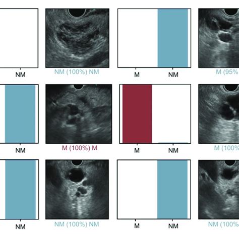 Output Provided During The Validation Phase Of The Convolutional Neural Download Scientific
