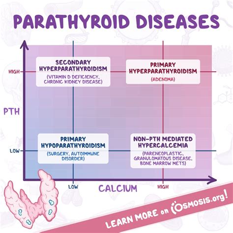 Primary Hyperparathyroidism Diagnosis 50 Off