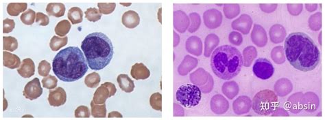 外周血单个核细胞攻略 知乎