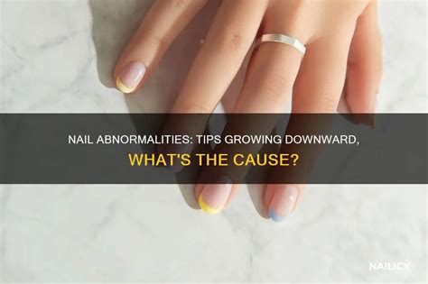 Nail Abnormalities Tips Growing Downward Whats The Cause Nailicy