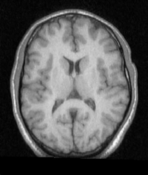 Preprocessing Flow Chart Input Image Is The Original Image Download Scientific Diagram