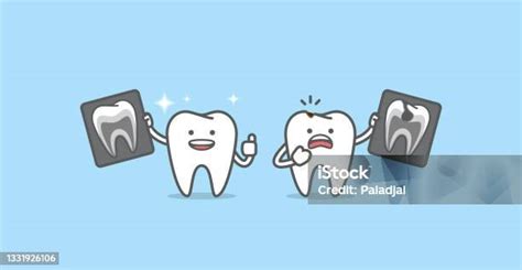치아 캐릭터와 X 선의 치과 만화는 파란색 배경에 좋은 상태 일러스트 만화 캐릭터 벡터 디자인을 비교합니다 치과 치료 개념 치과 의사에 대한 스톡 벡터 아트 및 기타 이미지