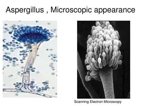Fundamentals Of Medicine Pathology Introduction To Microbiology Ppt