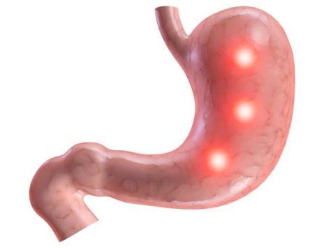 Болит желудок после алкоголя что делать