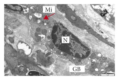 Structure And Morphology Of Egcs A Egcs Of The Blank Control Group