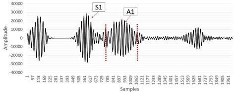 Lamb Modes Dispersion Curves For Phase Velocity Download Scientific Diagram