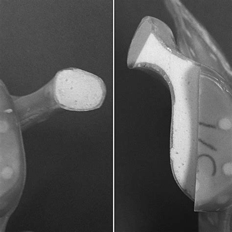Composite Scapula With 8 5 Mm 31 Glenoid Width And 21 Glenoid Download Scientific Diagram