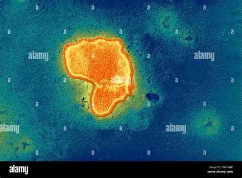 Respiratory Syncytial Virus Rsv Particle Coloured Transmission Electron Micrograph Tem